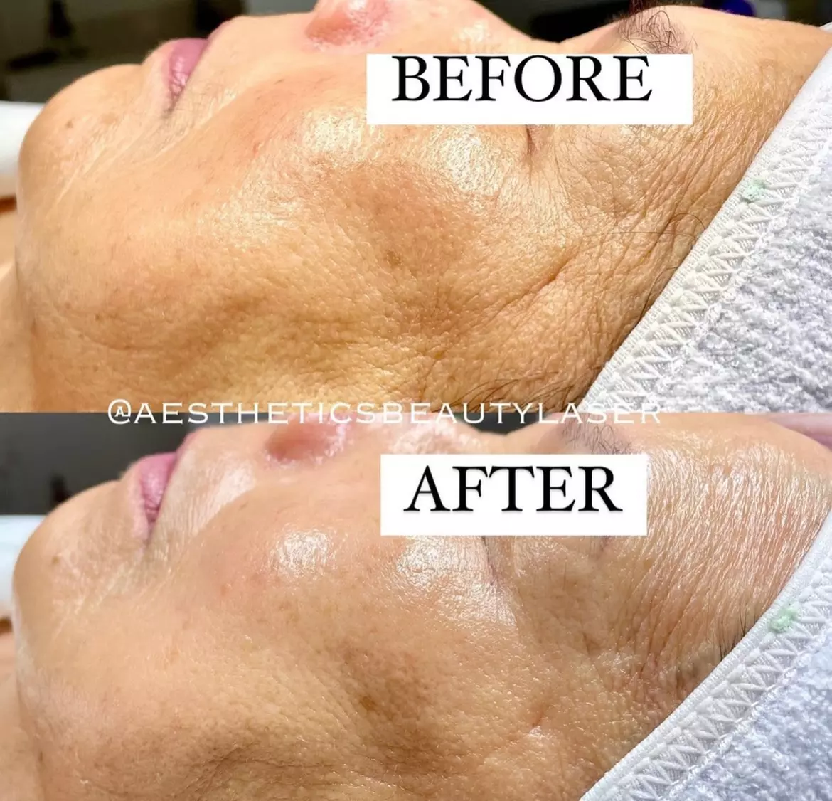 Aesthetics Beauty Laser in Alexandria | Groupon