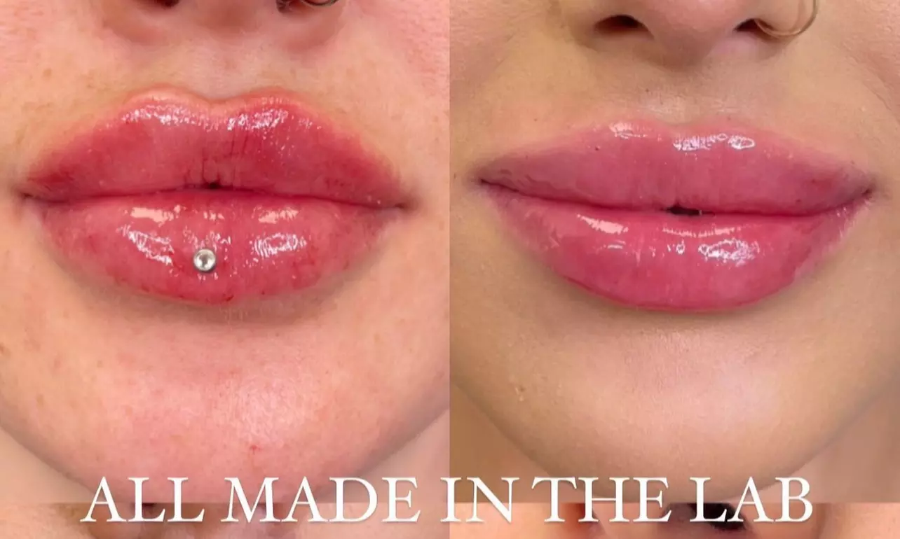 The Injector Lab Med Spa in Stoughton | Groupon