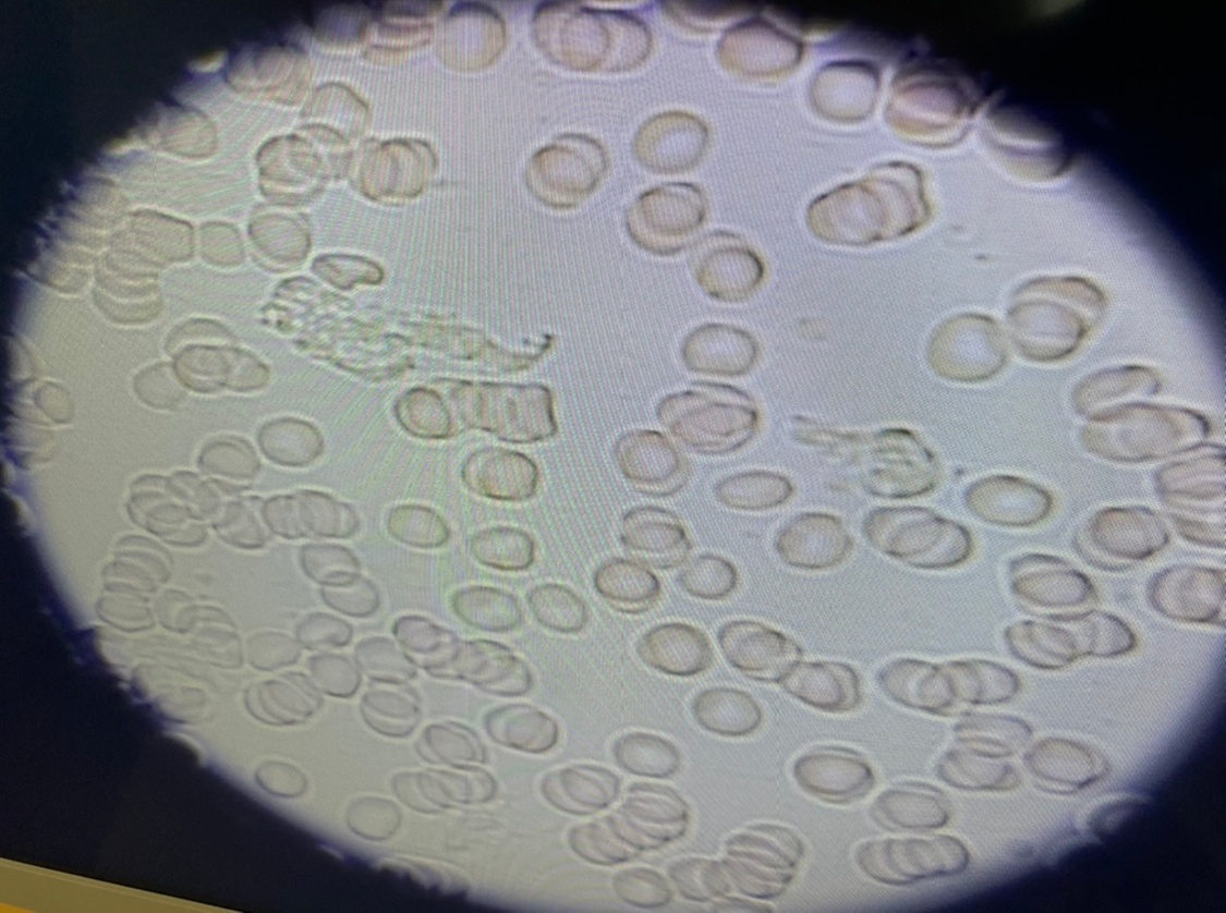 Liquid Gold Plasma in Palm Desert | Groupon