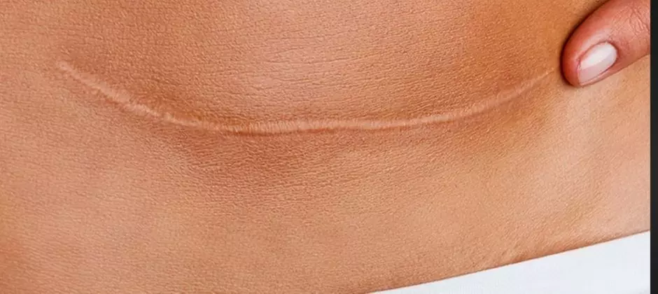 Body Goals Sculpting Studio in Evergreen Park | Groupon