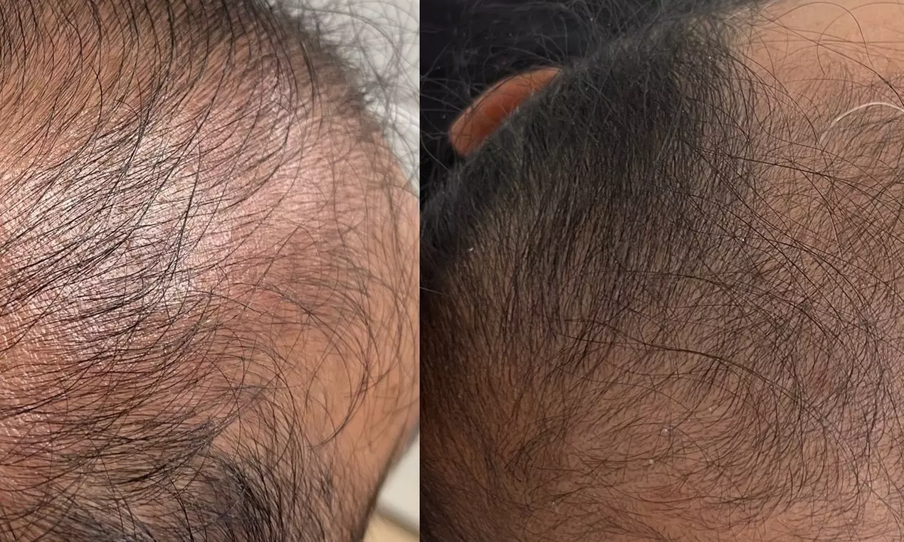 BodySense Aesthetic And wellness Center in Houston | Groupon