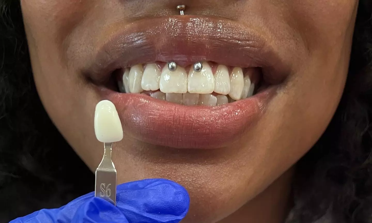 Tizzy’s teeth and bling in Charlotte | Groupon