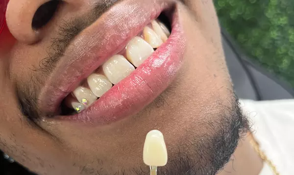 Tizzy’s teeth and bling in Charlotte | Groupon