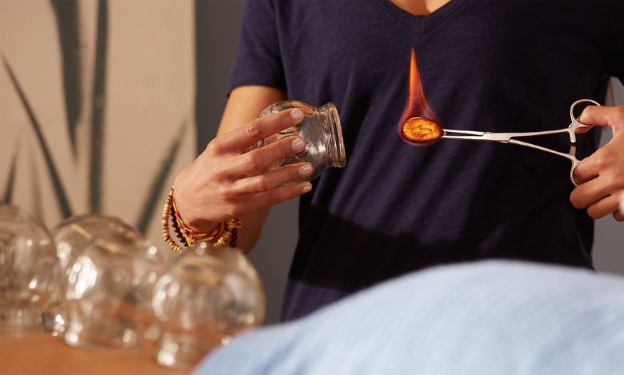 What Is Fire Cupping And Why You Should Try It