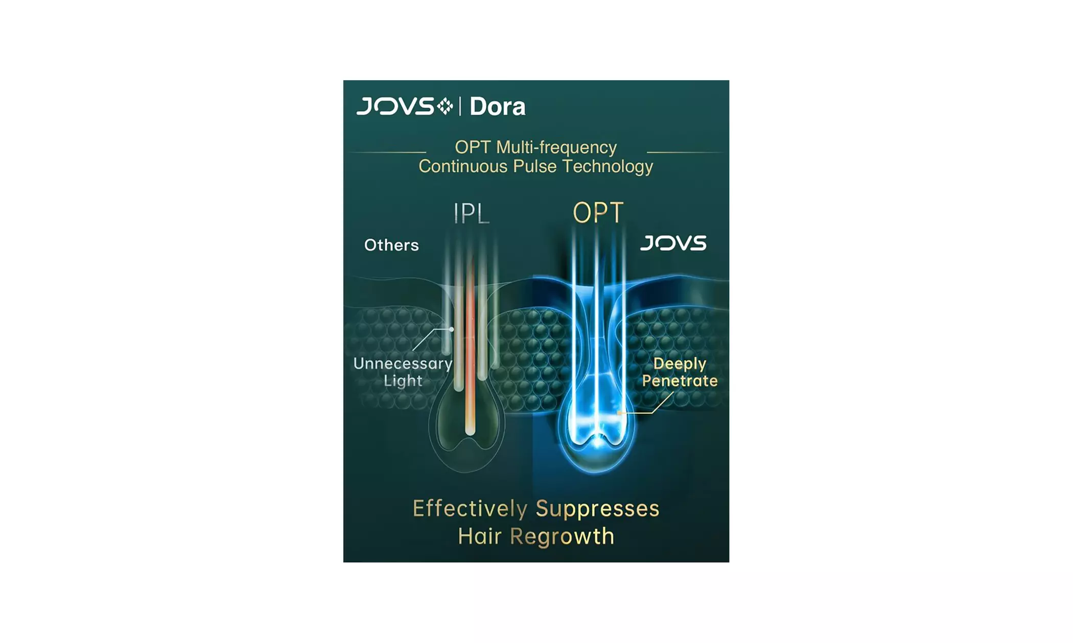 JOVS Dora IPL Hair Removal De... | Groupon Goods